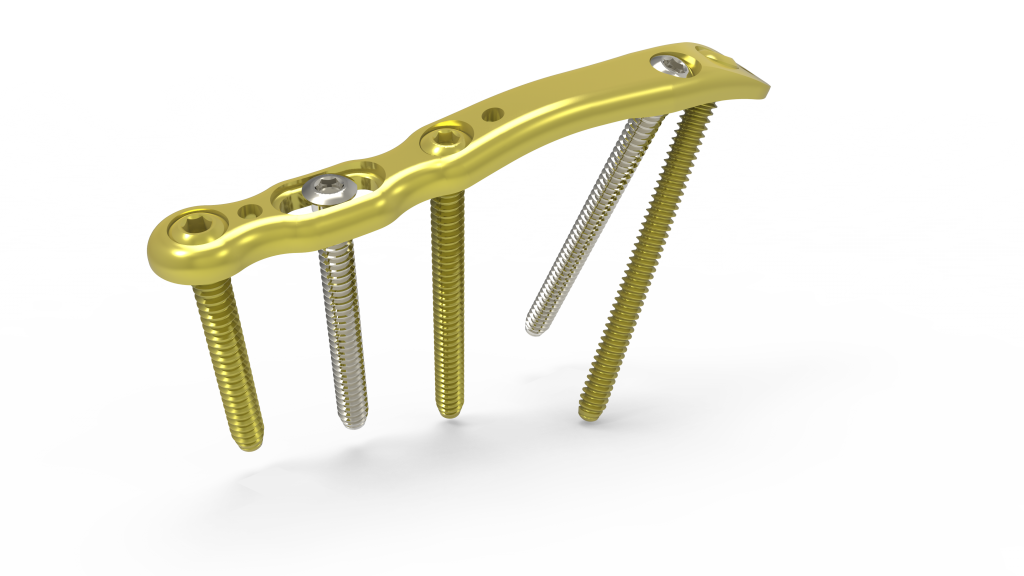 Acu-Loc 2 Wrist Plating System | Acumed