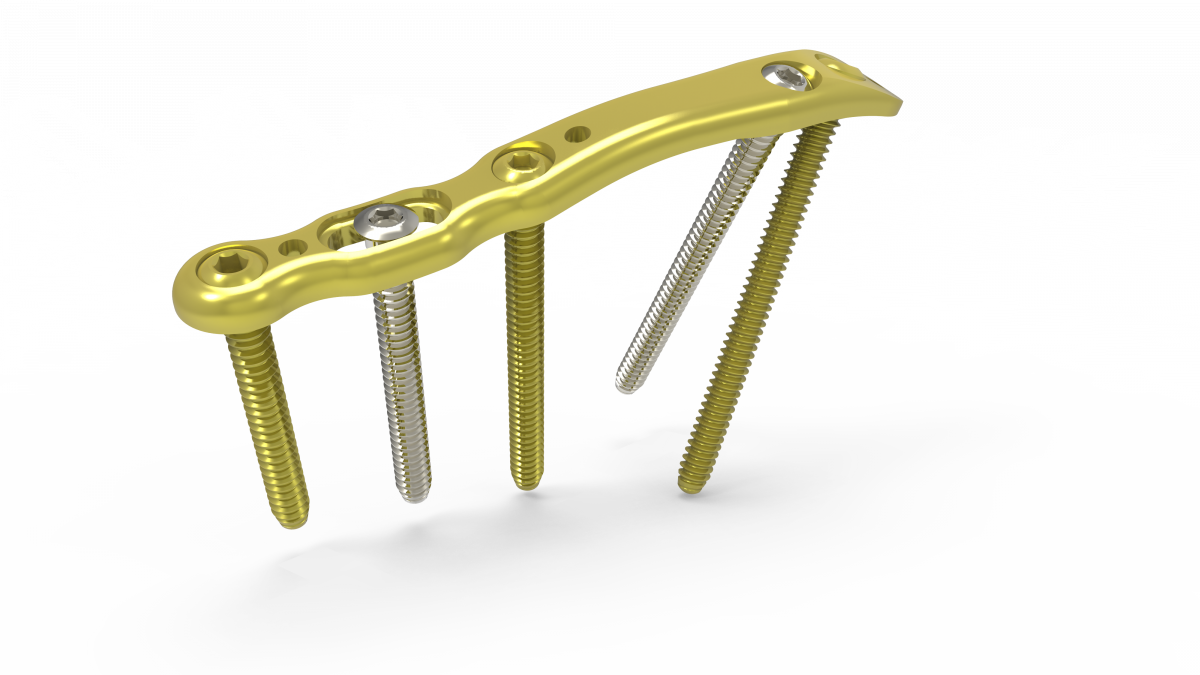 Divergent Radial Styloid Plate | Acumed