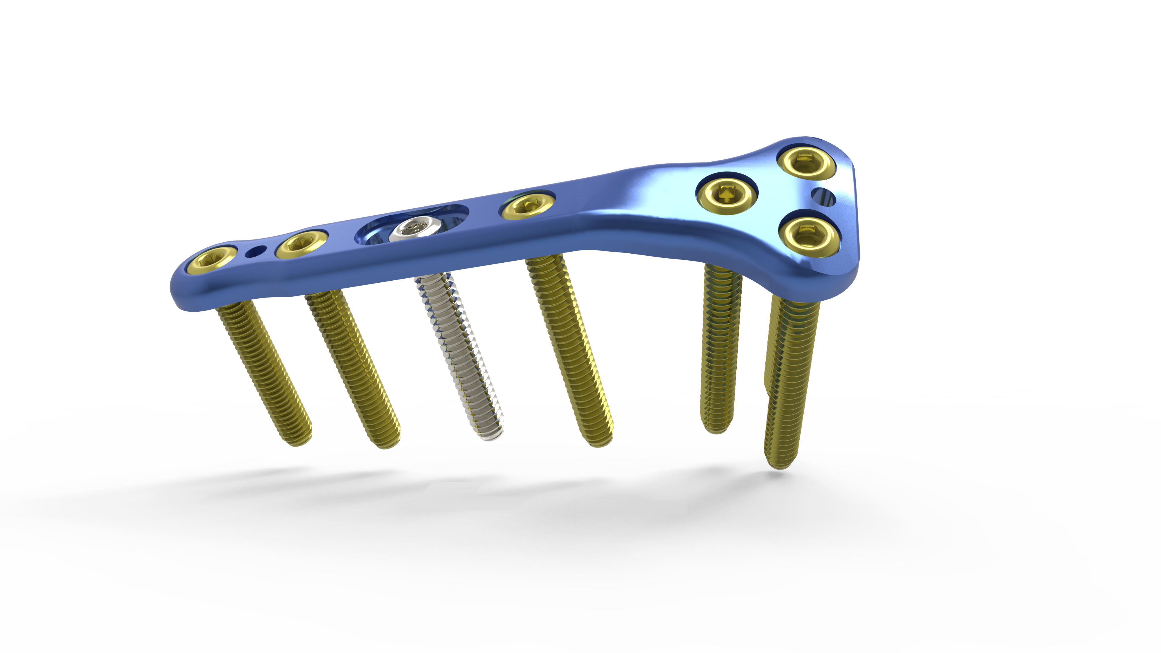 Acu-Loc 2 Wrist Plating System | Acumed