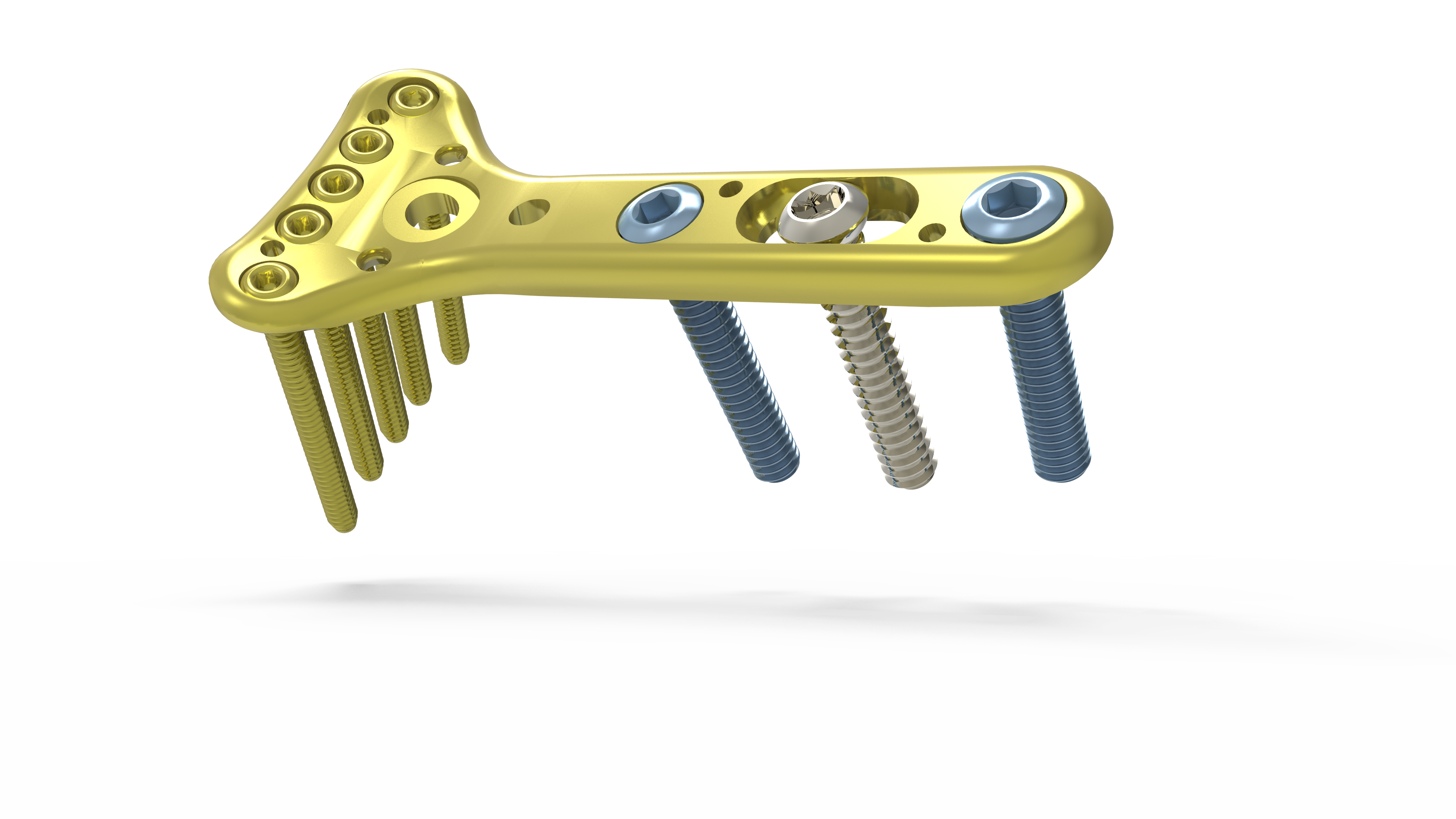 Extra-Articular Plates | Acumed