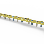 Acu-Loc 2 Wrist Plating System | Acumed