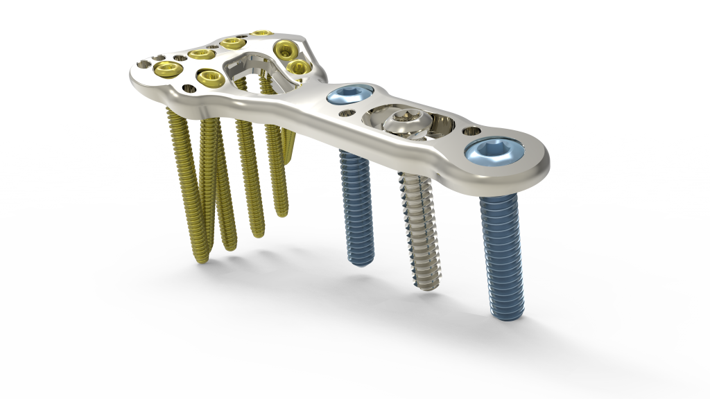 Acu-Loc 2 Wrist Plating System | Acumed