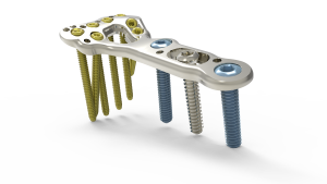 Acu-Loc 2 Wrist Plating System | Acumed