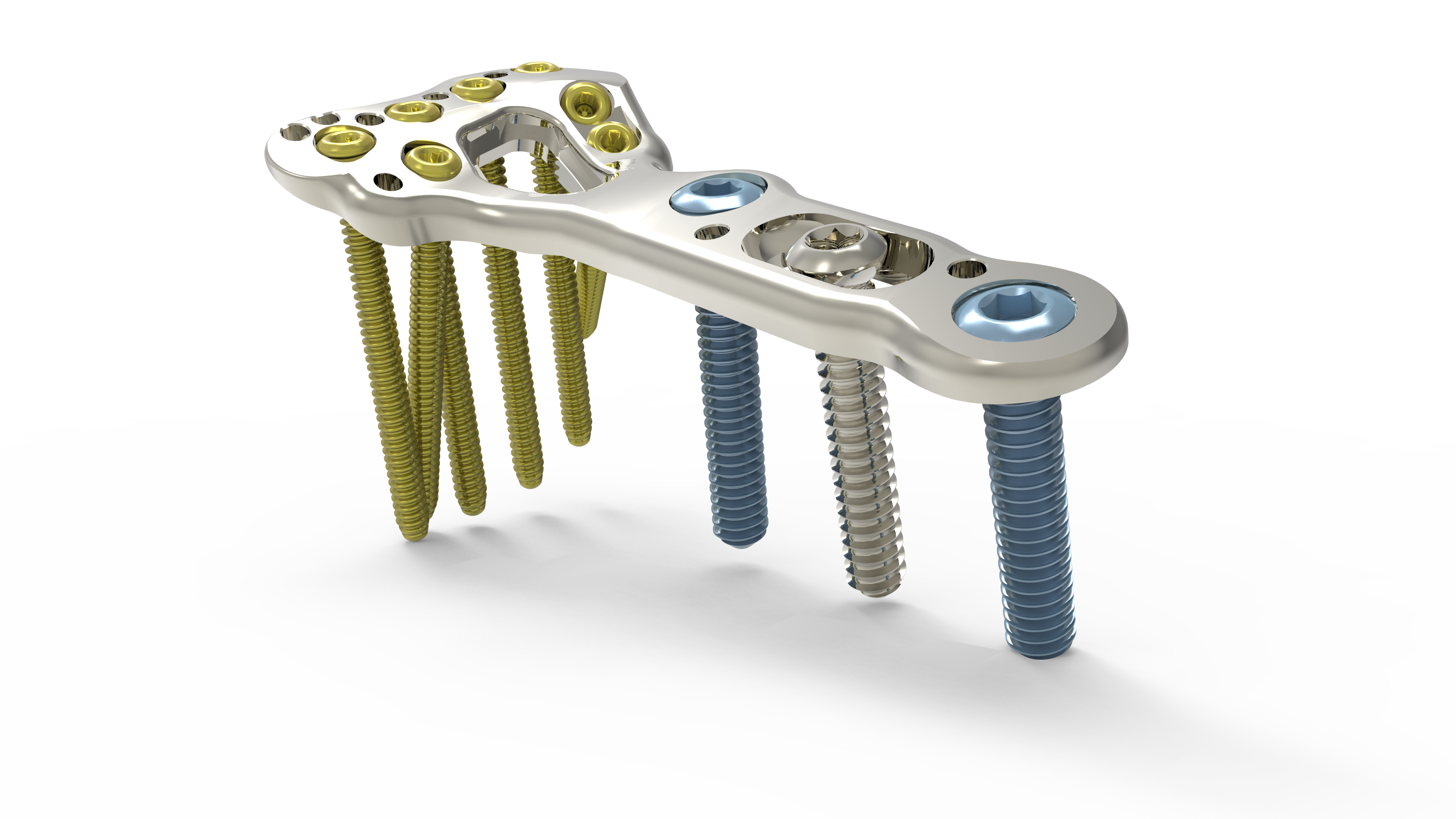 Acu-Loc 2 Wrist Plating System | Acumed