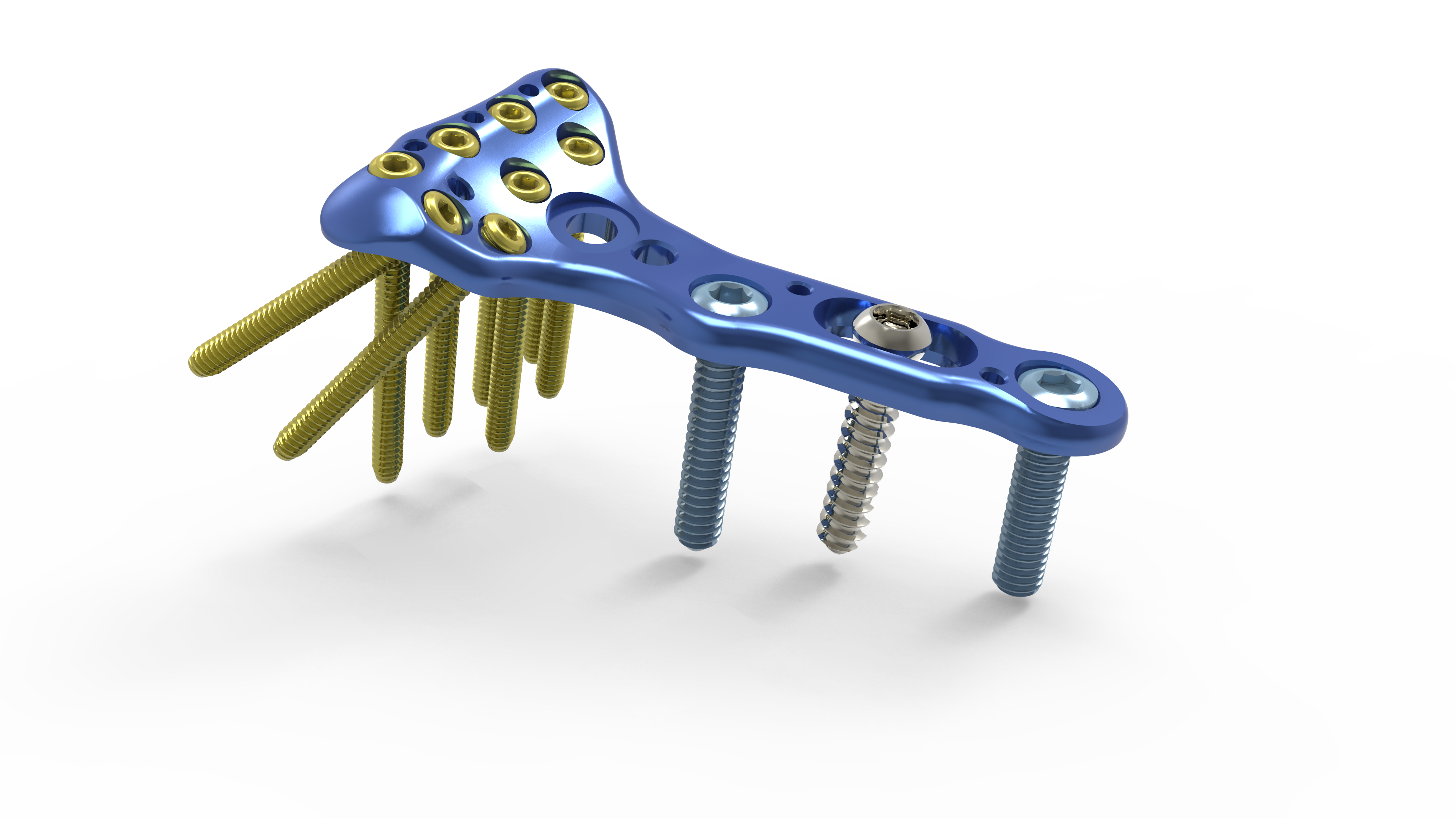 Acu-Loc Wrist Plating System | Acumed