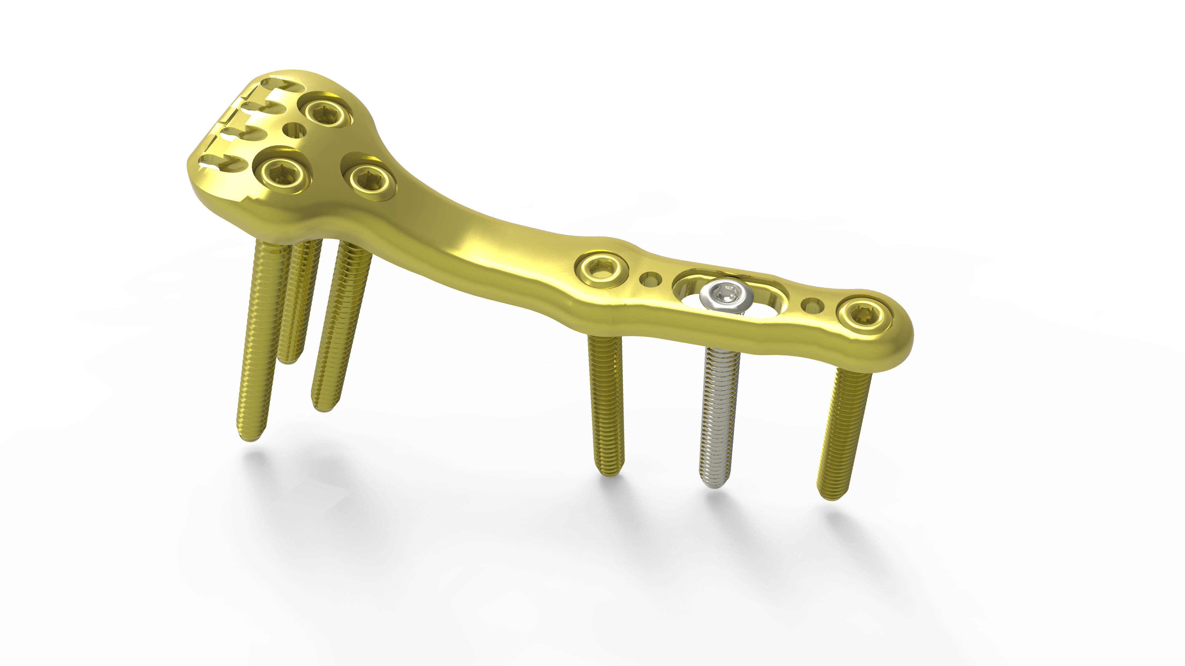Acu-Loc 2 Wrist Plating System | Acumed