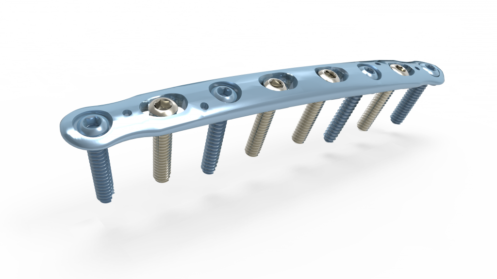 Dorsolateral Radius Plates | Acumed