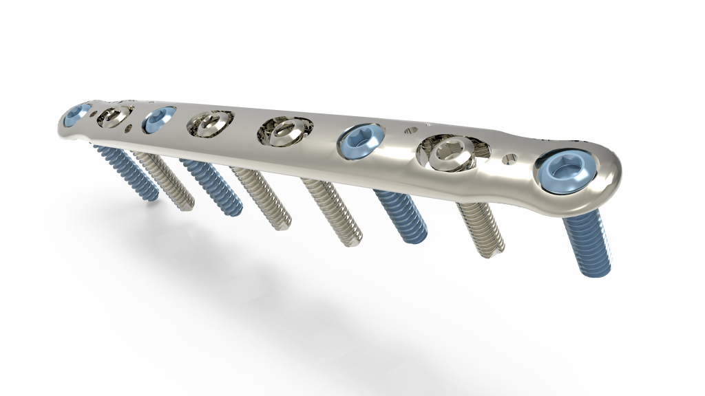 Midshaft Ulna Plate | Acumed