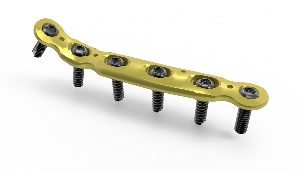 Clavicle Plating System | Acumed