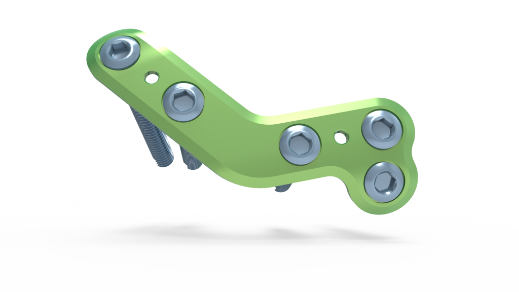 Calcaneal Plating System | Acumed