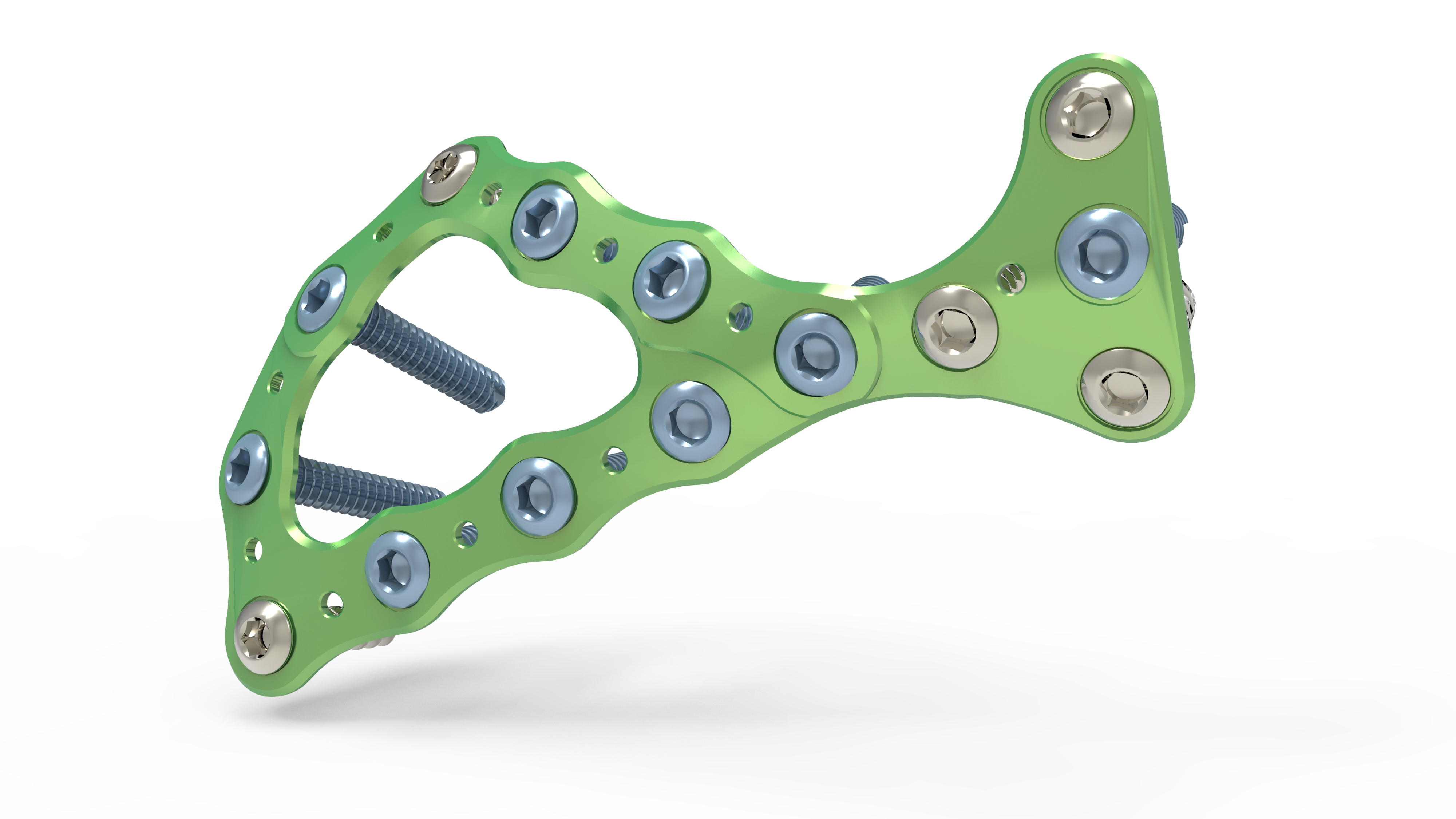 Lateral Wall Plate | Acumed