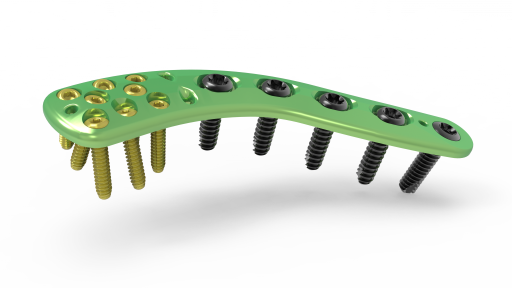 Clavicle Plating System | Acumed