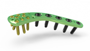 Clavicle Plating System | Acumed