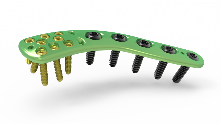 Distal Clavicle Plate | Acumed