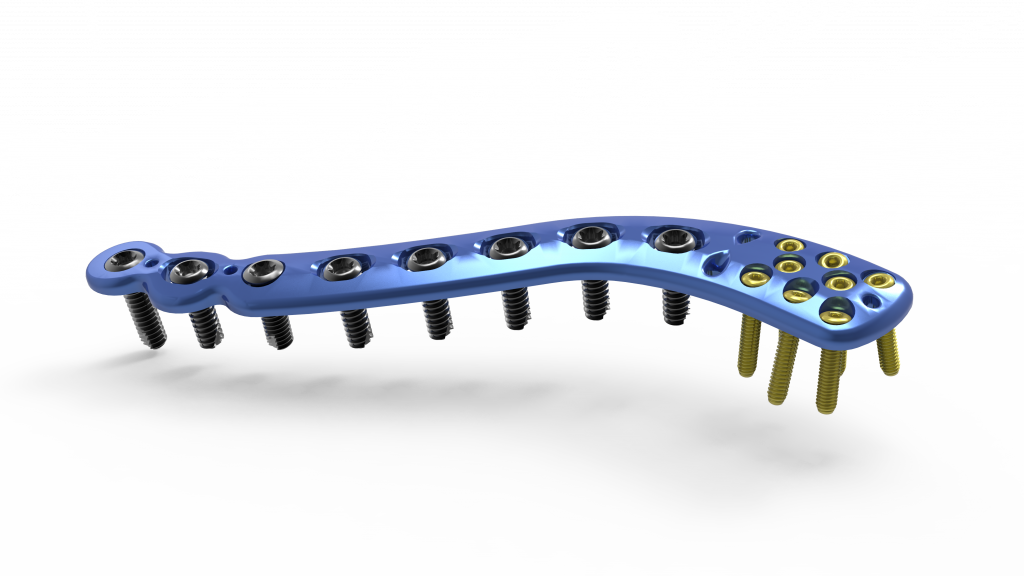 Clavicle Plating System | Acumed