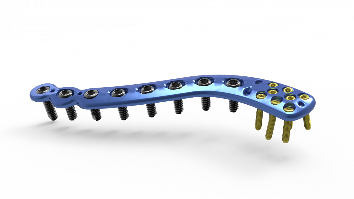 Distal Clavicle Plate | Acumed