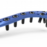 Clavicle Plating System | Acumed