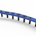 Clavicle Plating System | Acumed