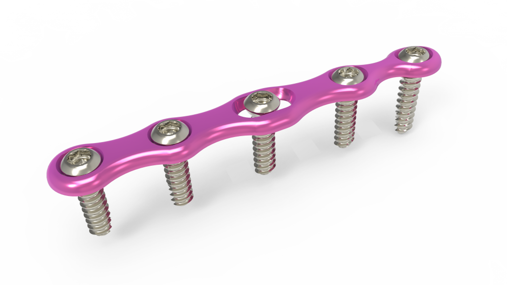 Locking Ankle Plating System | Acumed