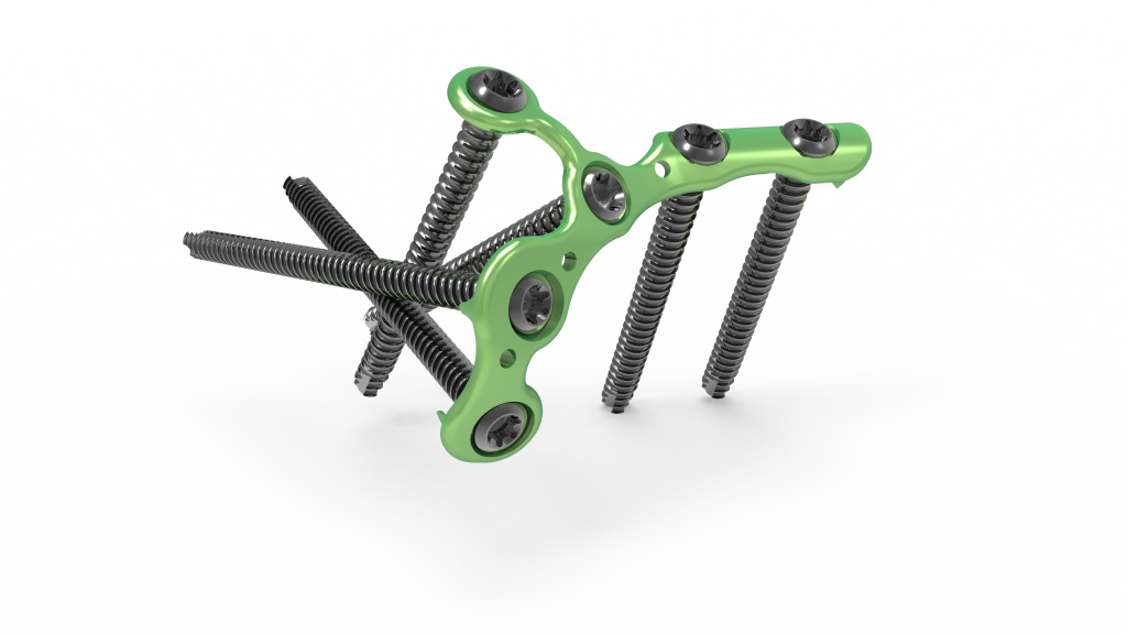 Elbow Plating System | Acumed