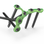 Elbow Plating System | Acumed