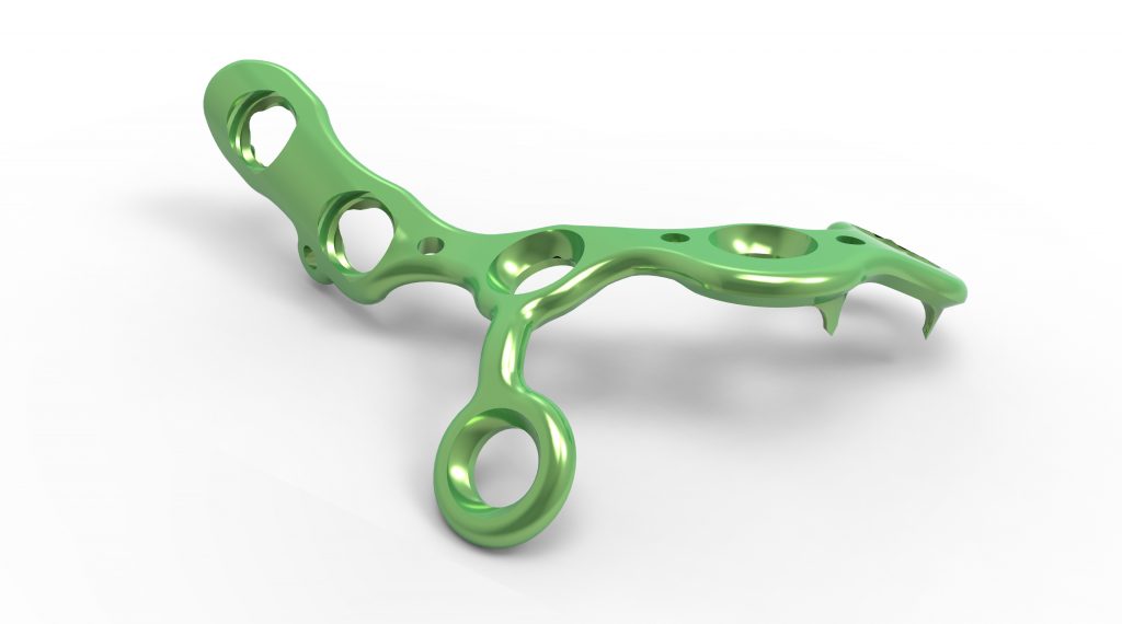 Elbow Plating System | Acumed