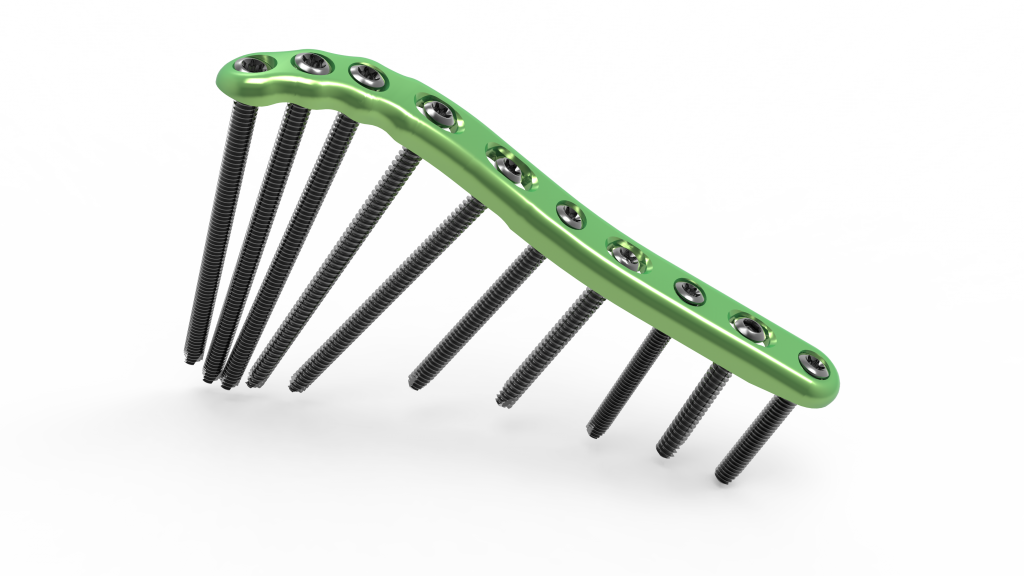 Elbow Plating System | Acumed