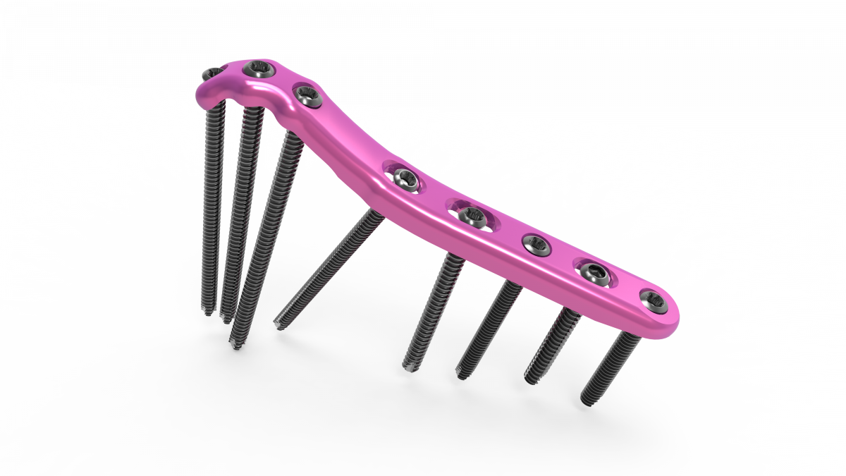 Medial Column Plate | Acumed