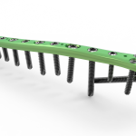 Elbow Plating System | Acumed