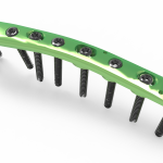 Elbow Plating System | Acumed