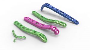 Elbow Plating System | Acumed