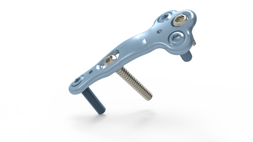 Forefoot-Midfoot Plating System | Acumed