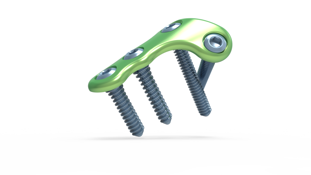 Forefoot-Midfoot Plating System | Acumed