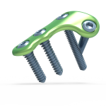 Forefoot-Midfoot Plating System | Acumed