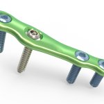 Forefoot-Midfoot Plating System | Acumed