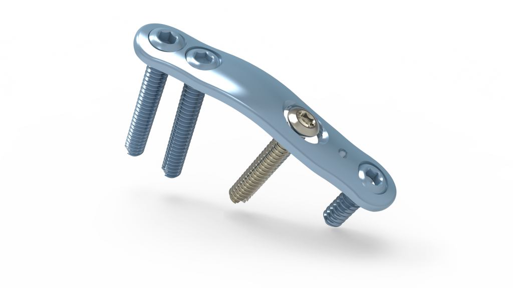 Forefoot-Midfoot Plating System | Acumed