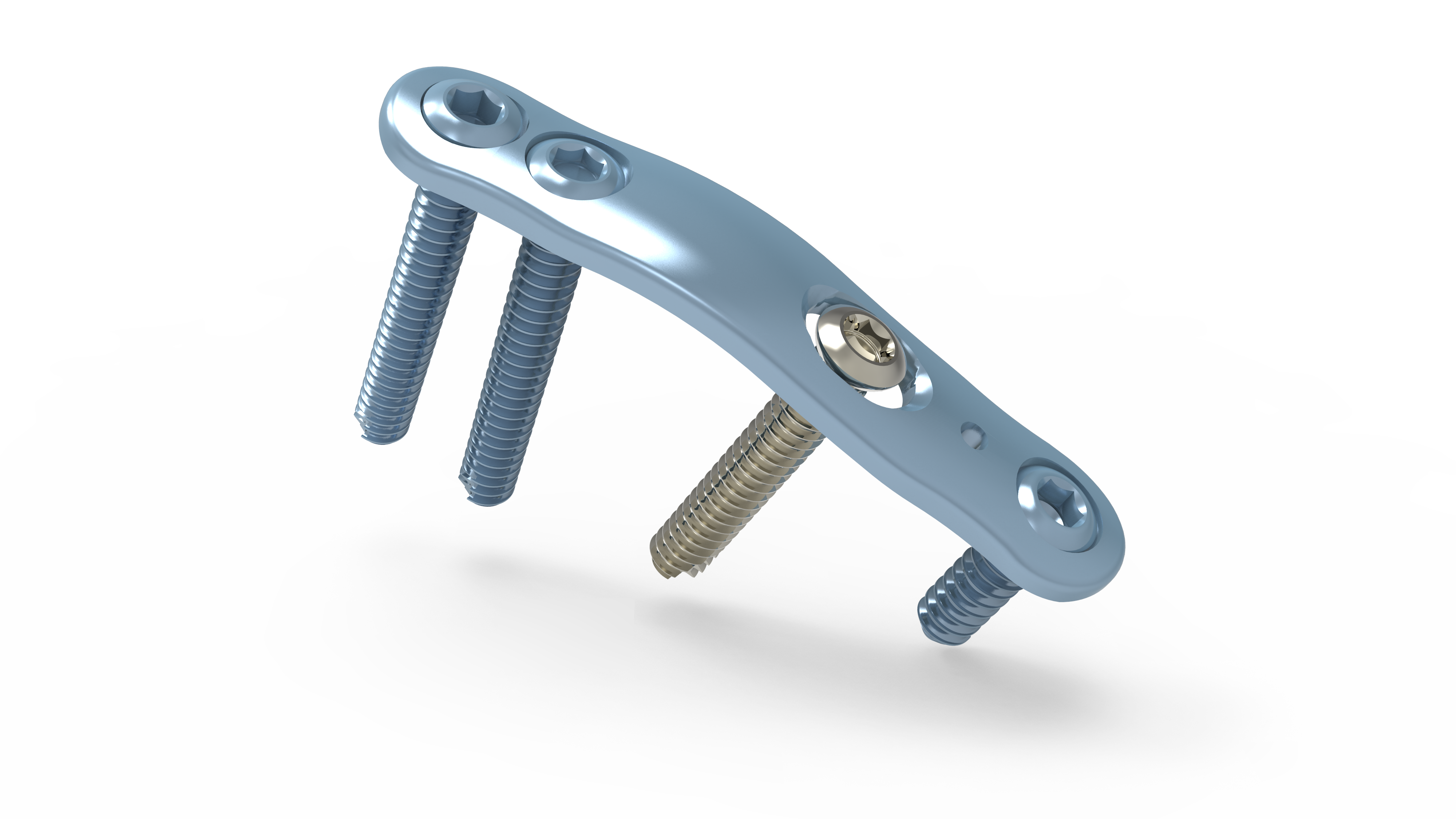 Locking 2nd and 3rd TMT Plate | Acumed