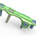 Forefoot-Midfoot Plating System | Acumed