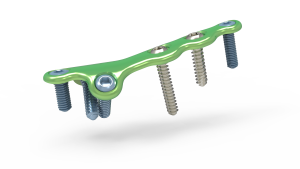 Forefoot-Midfoot Plating System | Acumed