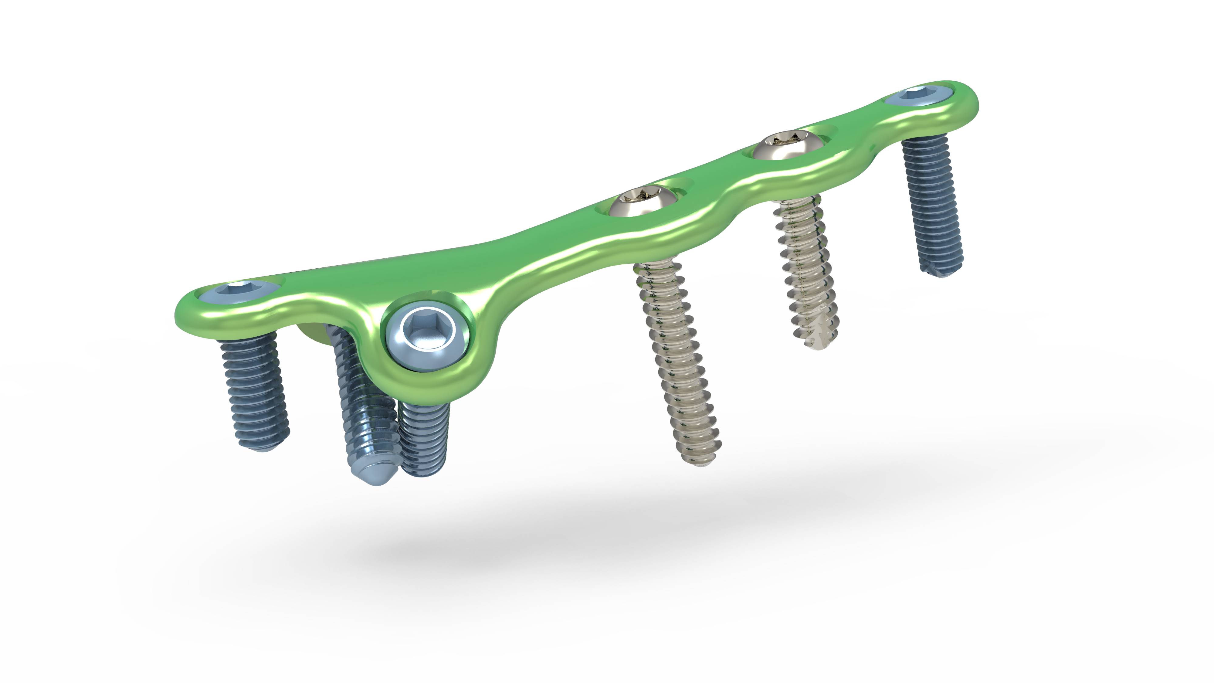 Locking MTP Revision Plate | Acumed