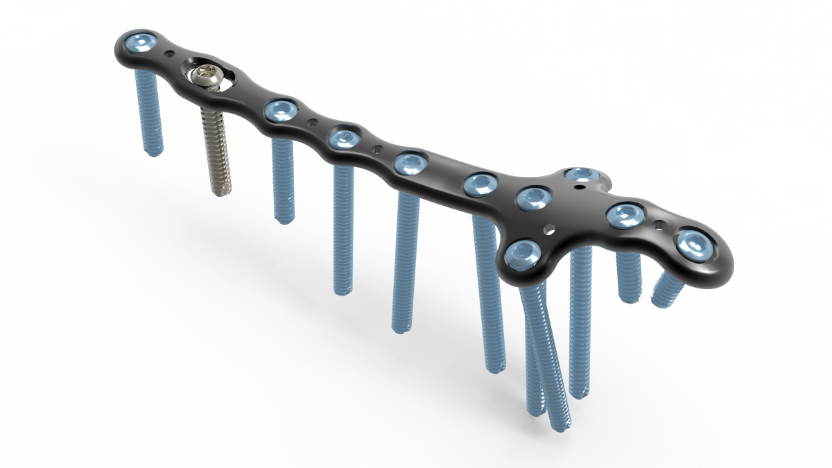 Medial Tibia Plate | Acumed