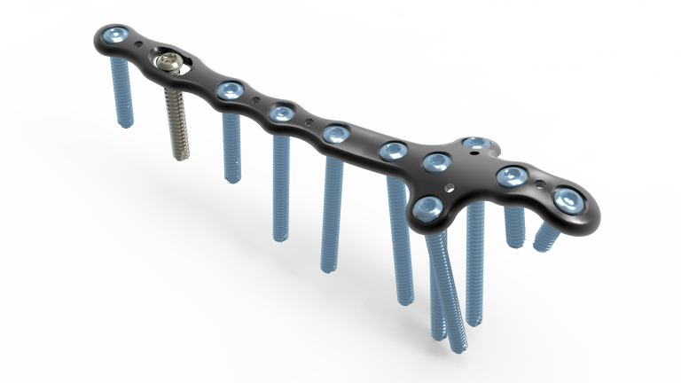 Medial Tibia Plate | Acumed