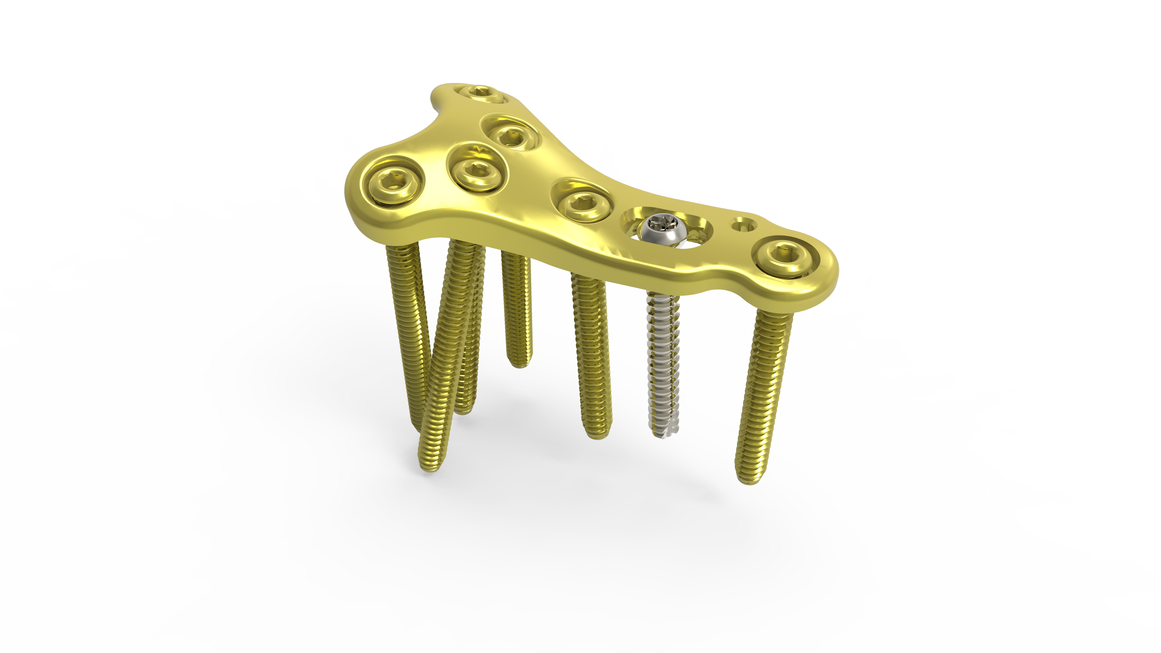 Radial Head Plating System | Acumed