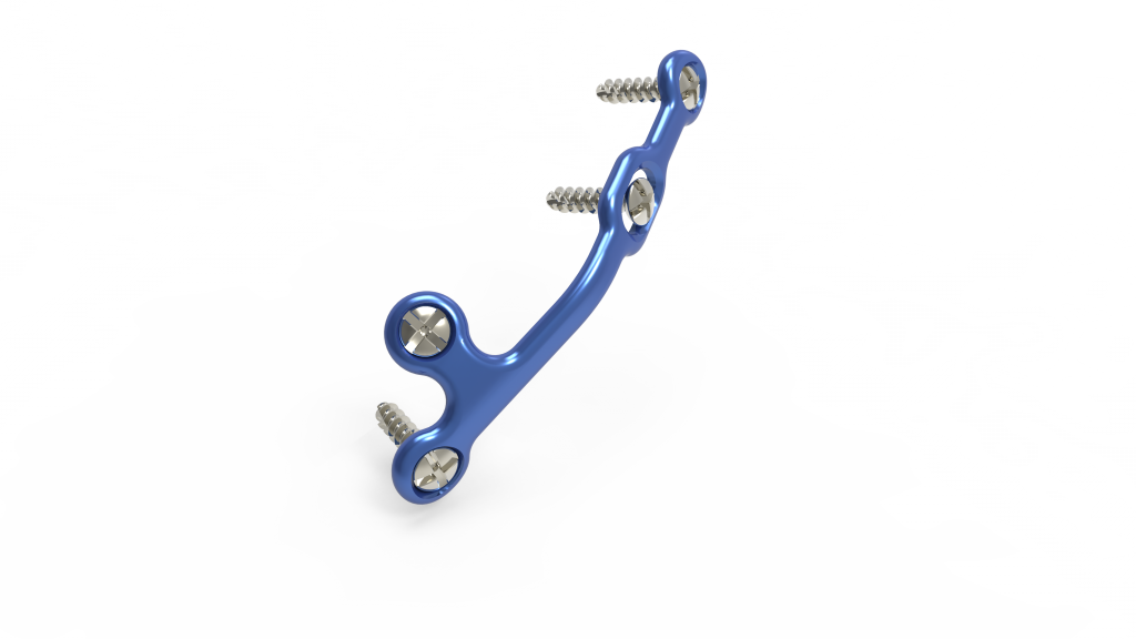 Modular Hand System | Acumed