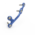 Modular Hand System | Acumed