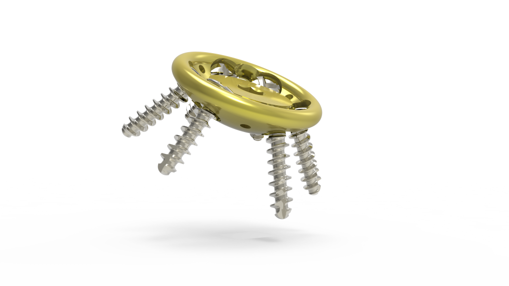 Modular Hand System | Acumed