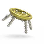 Modular Hand System | Acumed