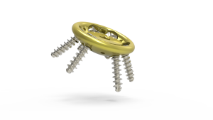 Modular Hand System | Acumed