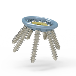 Modular Hand System | Acumed