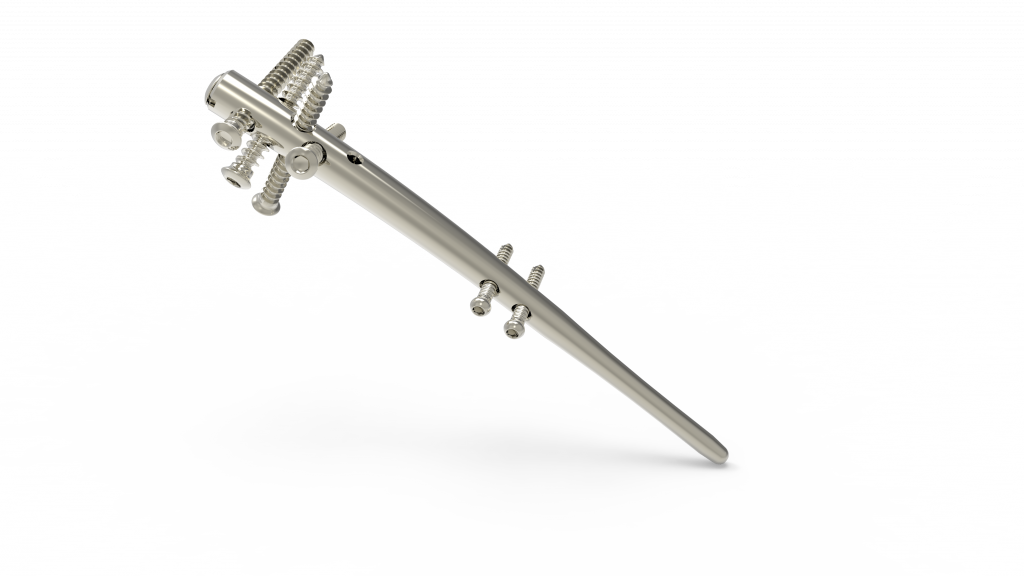 Polarus Humeral Rod System | Acumed